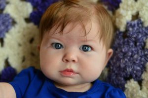 Pierre Robin Sequence and Stickler Syndrome